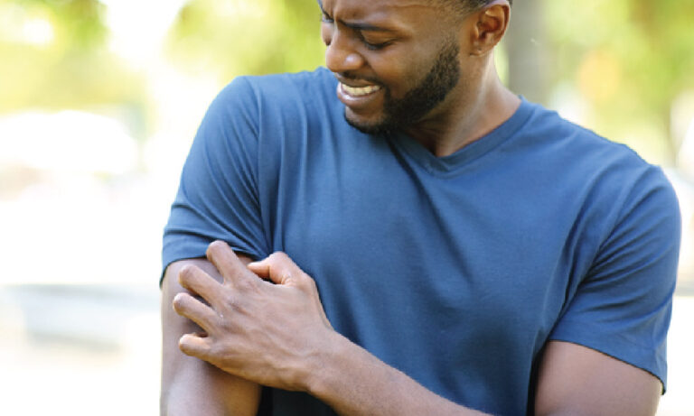 Why do we Itch? - Itch Insight